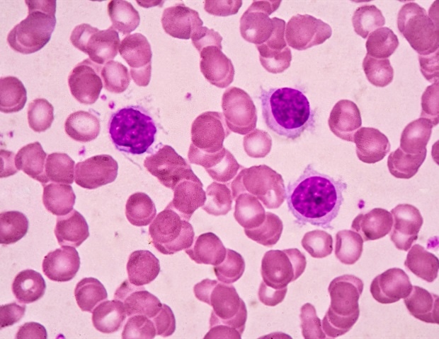 leukemia cells
