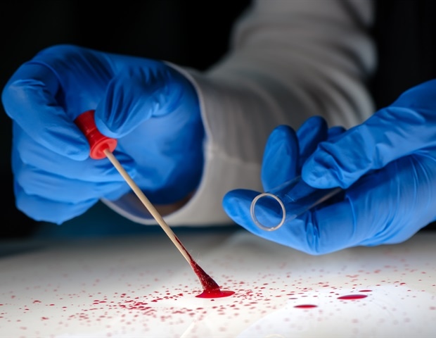 New drug testing analyzer from Siemens Healthineers raises the bar for ...