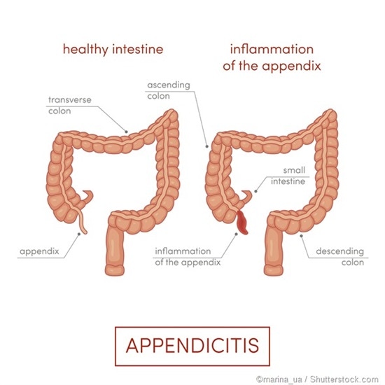 What is the Appendix?