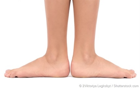 Flexible vs Rigid Flat Foot