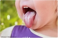 thrush lips toddler