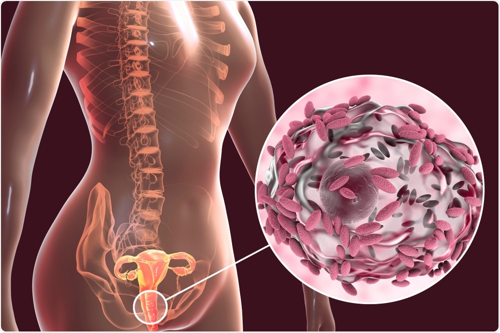 Oral Sex Can Trigger Bacterial Vaginosis