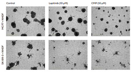 Introducing real-time live-cell analysis with the Incucyte®
