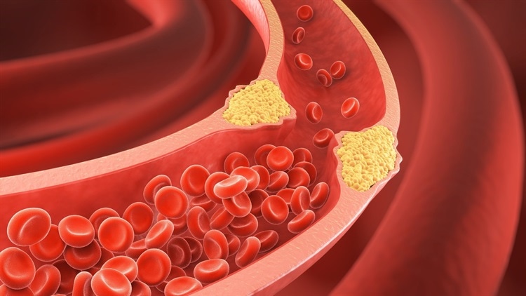 One shot to lower cholesterol for life? Scientists unlock a ...