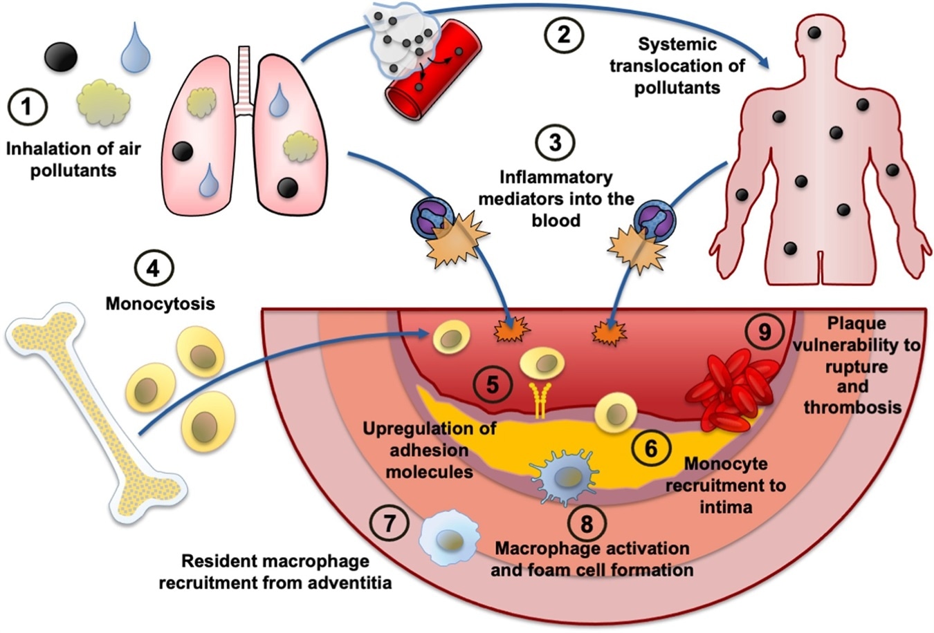 Air pollution fuels artery damage and accelerates heart disease, review ...