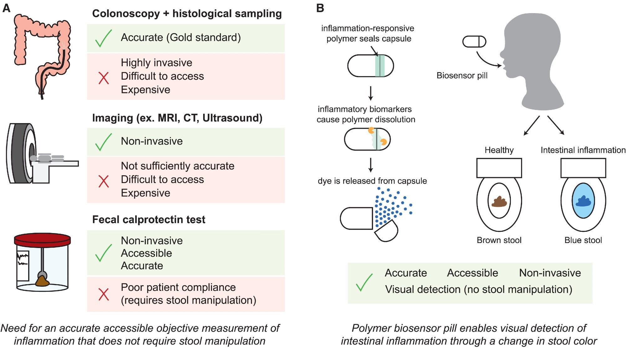 New swallowable sensor pill reveals gut inflammation with a simple ...