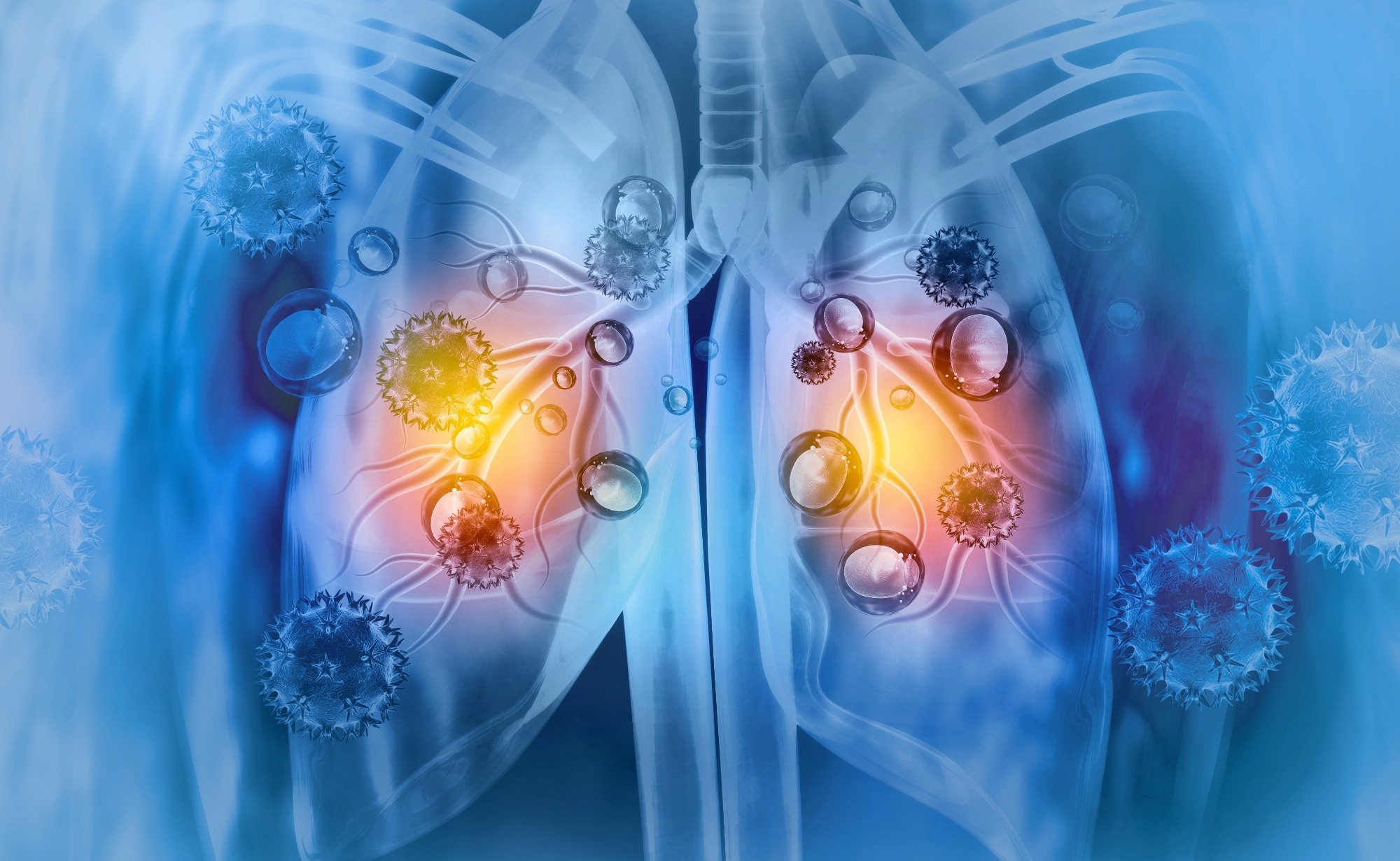 Respiratory viruses awaken dormant breast cancer cells and raise ...