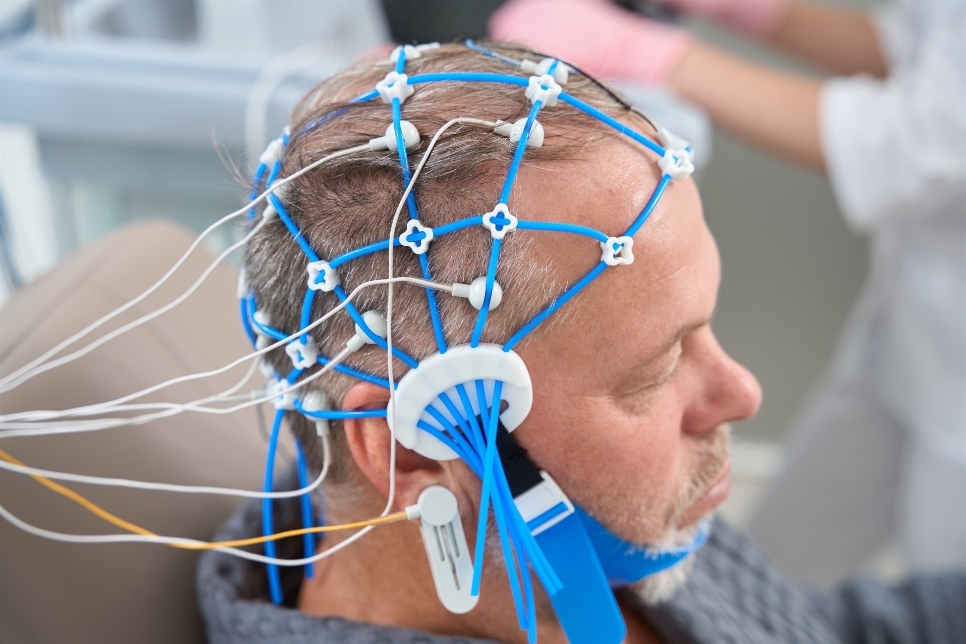 EEG fastball method: A new tool for alzheimer's detection