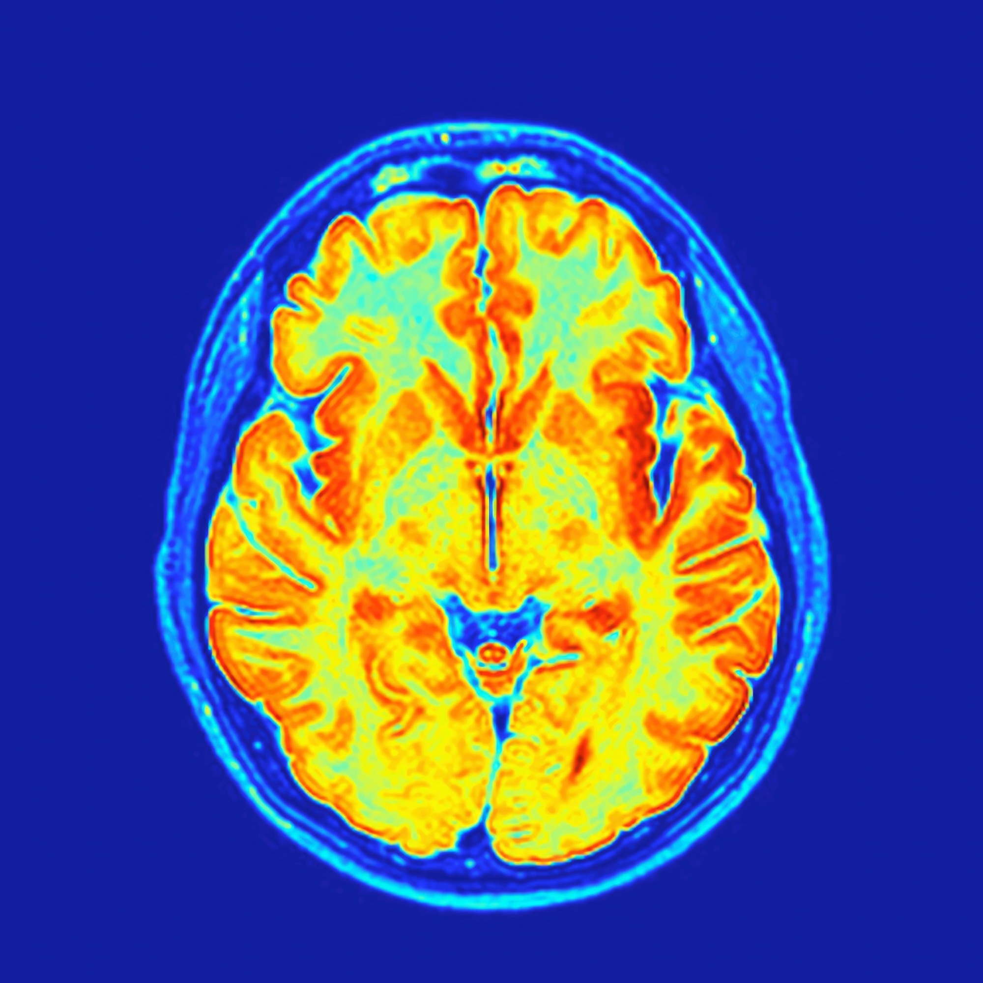 Seeing and feeling merge in the brain to shape perception