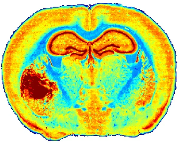 Using spectral imaging to study brain tumors in 3D: an interview Dr ...