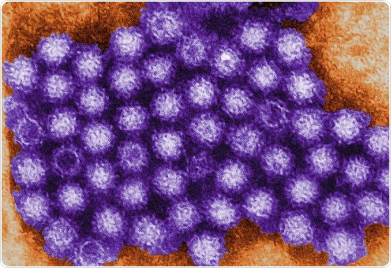 What is Norovirus?