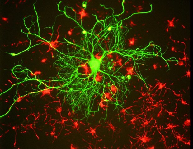 Tau Protein Function