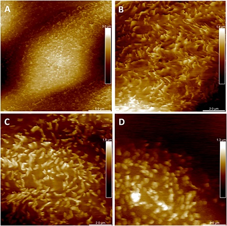 AFM Images of microvilli on live cells taken for the first time