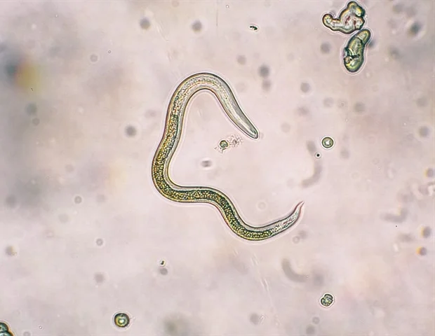 Ocular Larva Migrans Symptoms and Causes