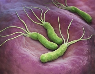 Helicobacter Pylori Tests