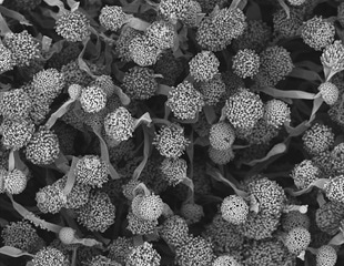 Viewing Foodborne Pathogens through Light and Electron Microscopes