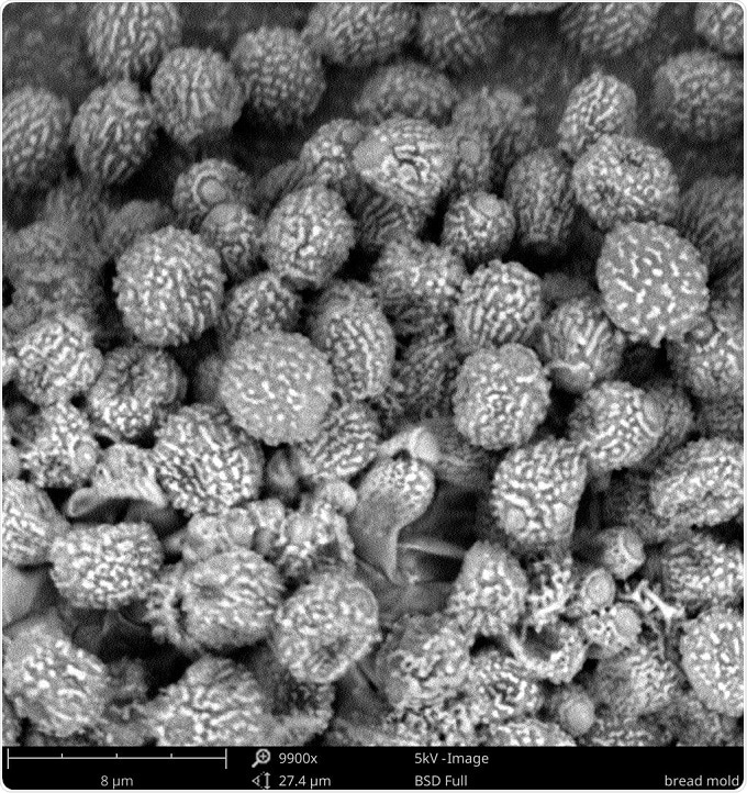 Viewing Foodborne Pathogens through Light and Electron Microscopes