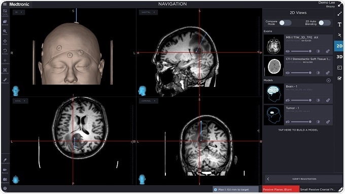 Medtronic introduces new StealthStation S8 technology for neurosurgery