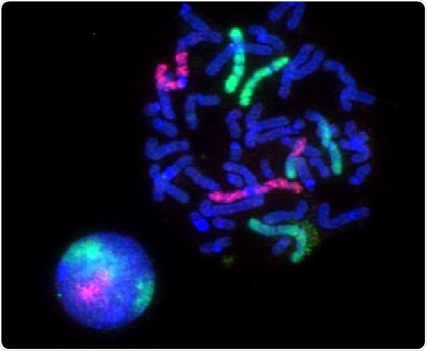 How do Epifluorescence Microscopes Work?