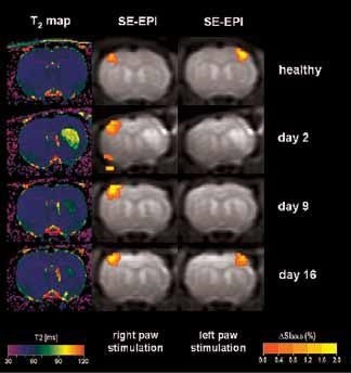 High Resolution BOLD Functional MRI Provides New Insights on Rat Brain