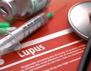 What is Lupus?