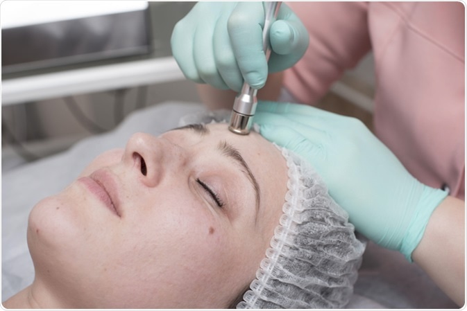 What is Dermabrasion?