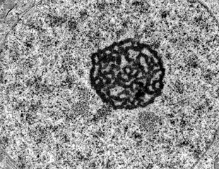 Sample Preparation in TEM
