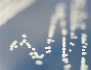 Two Hybrid Screening: Advantages and Disadvantages