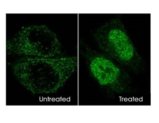 A Short Overview of Hypoxia Markers