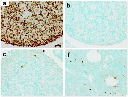 TUNEL Staining: An Overview