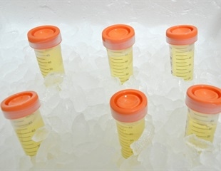 The Baculovirus Expression Vector System (BEVS)