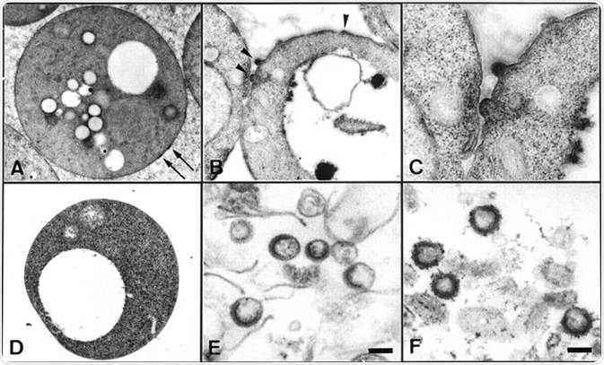 What are Spheroplasts?