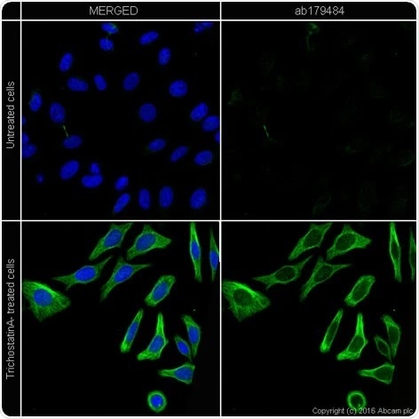 Understand the Tubulin Code with Microtubules