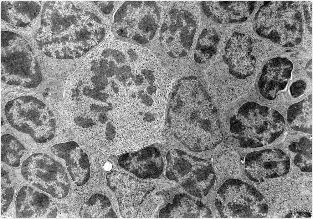 Cryo-electron Tomography Applications