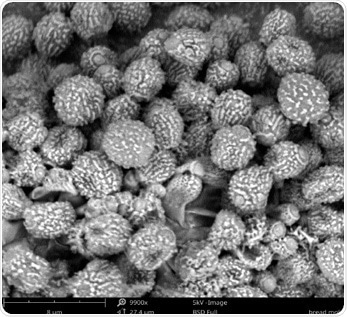 Studying Foodborne Pathogens using Electron Microscopy