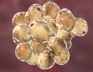 Adipo-Clear Overview