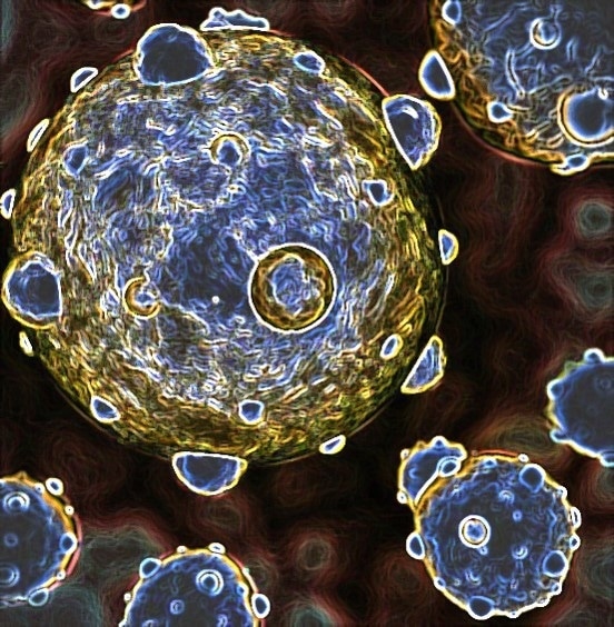 Exosomes: Are They All Alike and Why Does it Matter?