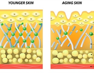 Glycation and Skin Aging