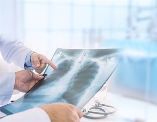 Lung Plethysmography Procedure