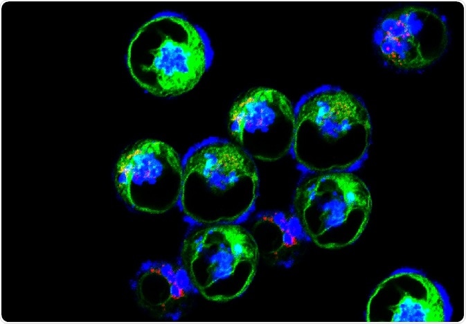 How to Analyze Cellular Necroptosis