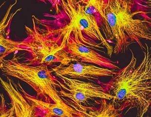 Cell Metabolism Assays