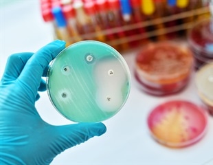 Surface Localized Antimicrobial Display Applications