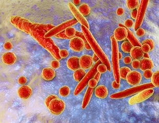 Sources of Mycoplasma in Cell Culture