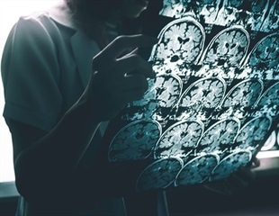 How Does the Suprachiasmatic Nucleus (SCN) Control Circadian Rhythm?