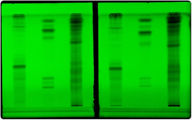 Thin Layer Chromatography