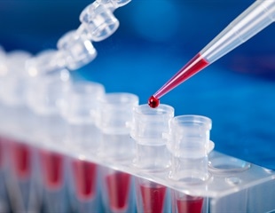 Transfer-PCR (tPCR) Applications