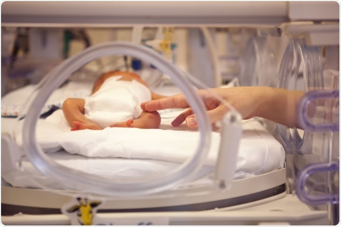 Risk of health conditions among adults who were born premature
