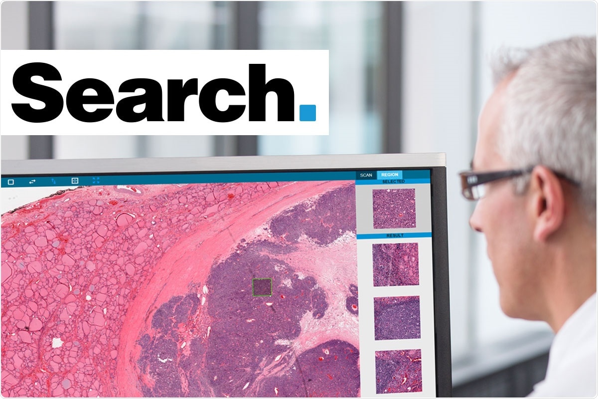 Driving Adoption of Digital Pathology with Image Search