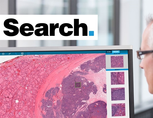 Driving Adoption of Digital Pathology with Image Search