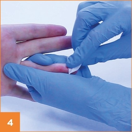 Relevance of Capillary Blood Sampling for Hemoglobin Results